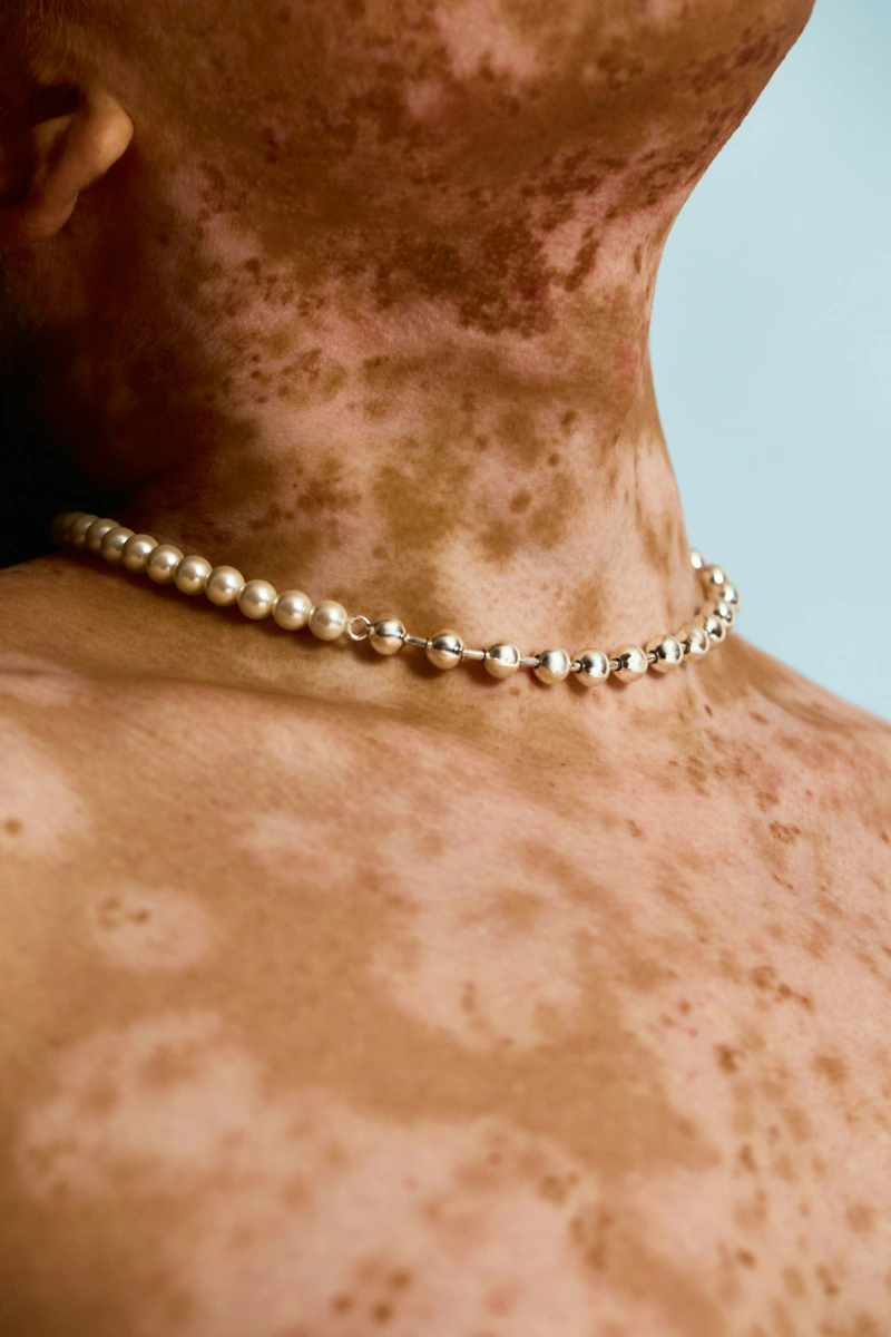 Nashville Dermatologist | Dr. Michael Gold - Gold Skin Care Center ...